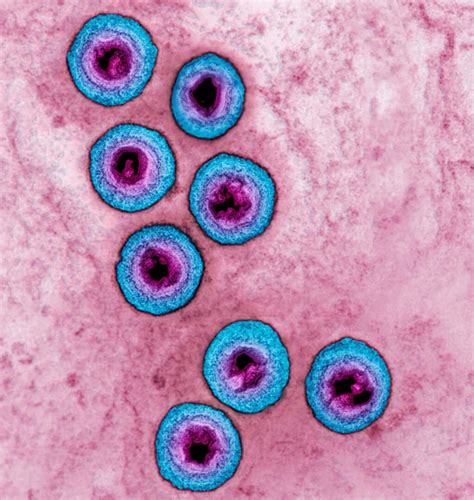 Heads Up You Probably Have Herpes And You Definitely Don T Know It Maxim