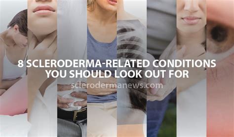 8 Scleroderma Related Conditions You Should Look Out For