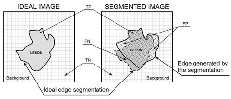 Ideal Segmentation And Automatic Segmentation 48 Download Scientific Diagram