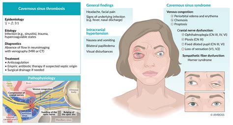 Cavernous Sinus Syndrome Causes