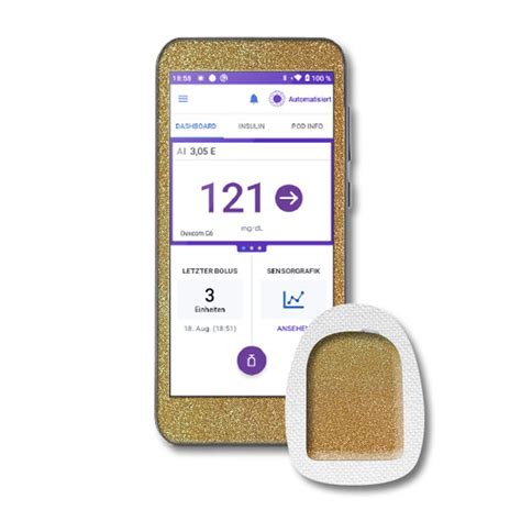 Omnipod 5 Controller Sticker Set Glitzer Gold Zuckerschmuck