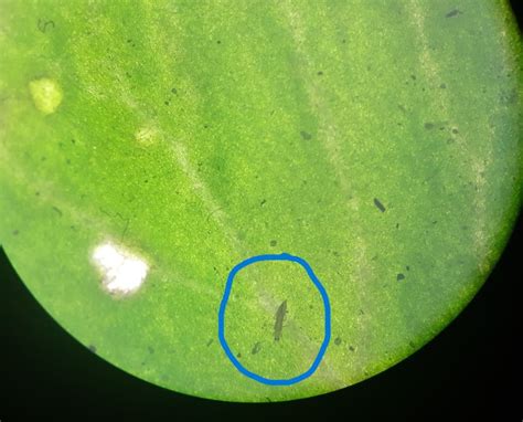 Gurleen Kaur On Linkedin Microscopic View Of A Thrip Nymph