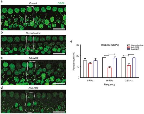 Epi Fluorescence And Quantitative Analysis Of Synaptic Puncta Density Download Scientific