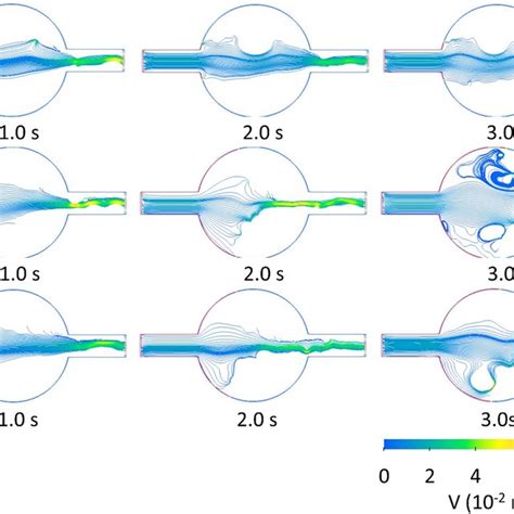Computed Phases Distribution With A Strong Water Wet Pore Surface