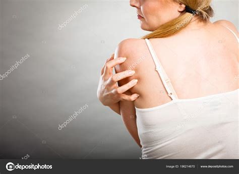 Health Problem Skin Diseases Young Woman Scratching Her Itchy Back