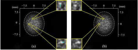 Typical Recorded Speckle Pattern Images A Before And B After The