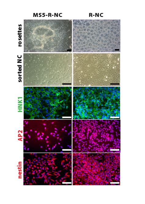 Feeder Free Derivation Of Neural Crest Progenitor Cells From Human Pluripotent Stem Cells