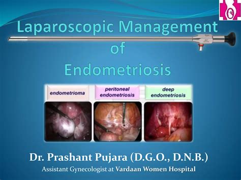 Laparoscopic Management Of Endometriosis Pptx