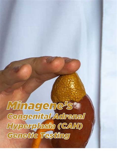 Minagenes Congenital Adrenal Hyperplasia Cah Genetic Testing