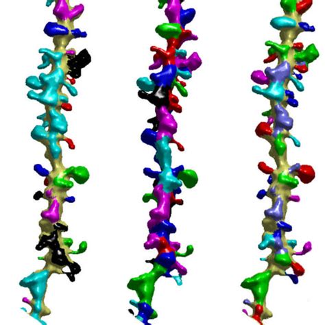Pdf A Novel Surface Based Geometric Approach For 3d Dendritic Spine Detection From Multi