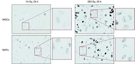 Iucr Spatial And Temporal Distribution Of γ H2ax Fluorescence In Human Cell Cultures Following