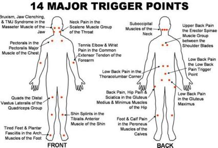 Trigger Point Therapy Flashcards Quizlet