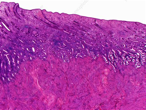 Human Uterus Light Micrograph Stock Image C055 6368 Science Photo Library