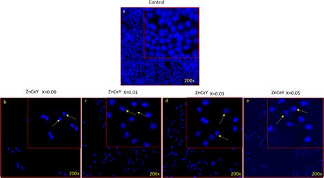 A E Cancer Cells Morphology By Dapi Staining It Shows The Impact Of Download Scientific