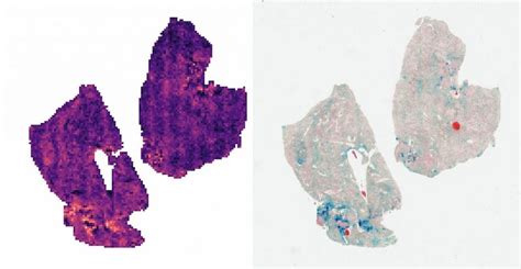 Mobidev Shares Research On Wsi Processing For Cancer Detection