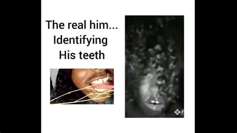 Identifying His Teeth Triviaandthe Real Him Pt2and Xxx Mobile Porno Videos And Movies Iporntvnet