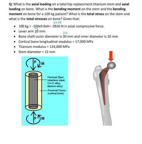 Solved Q What Is The Axial Loading On A Total Hip