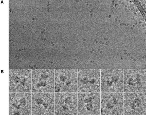 Em Of Atp Synthase Particles Frozen Atp Synthase Particles Were Imaged Em Of Atp Synthase Particles Frozen Atp Synthase Particles Were Imaged