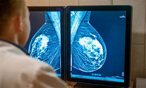 Mammography Radiology Group Of Abington