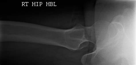 Test Yourself Regular Sets Set 32 Emergency Department Hips Radiology Courses