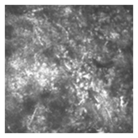 Case 1 A E Anterior Segment Photograph At Enrollment B F Download Scientific Diagram