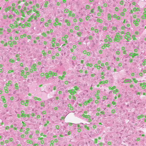 A Custom Cellpose Model For Hande Images Bioturing