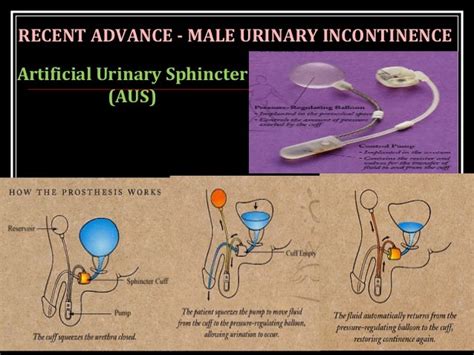 Micturition