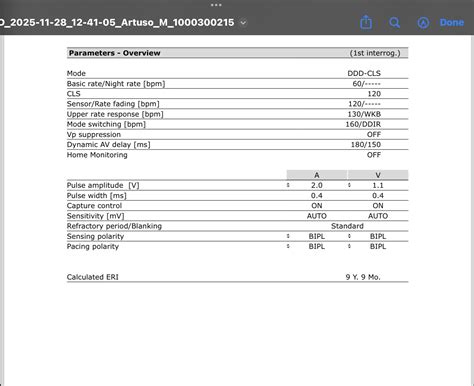 Pacemaker Club Can Someone Explain Upper Rate Response Meaning