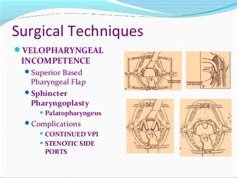 Clinical Aspects Of Cleft Lip And Palate Reconstruction 2 Rec