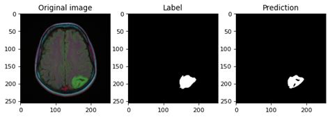 Github Ibrahimovnijatu Net Implementation Of 2d U Net Segmentation For Brain Mri Images