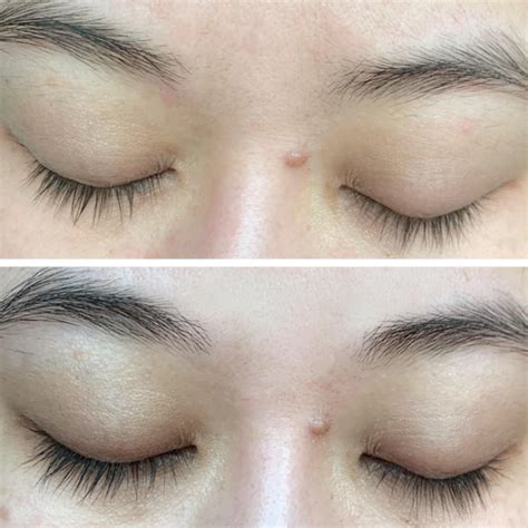 Lash Root Activator Liaison Growth