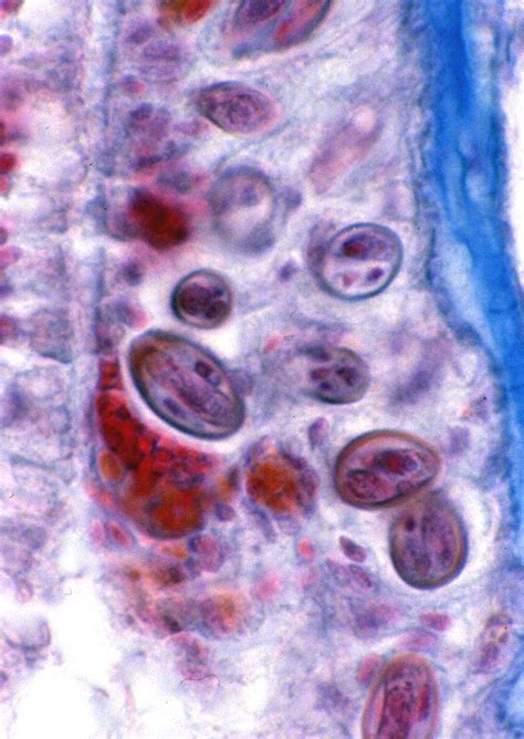 Apicomplexans Under Microscope