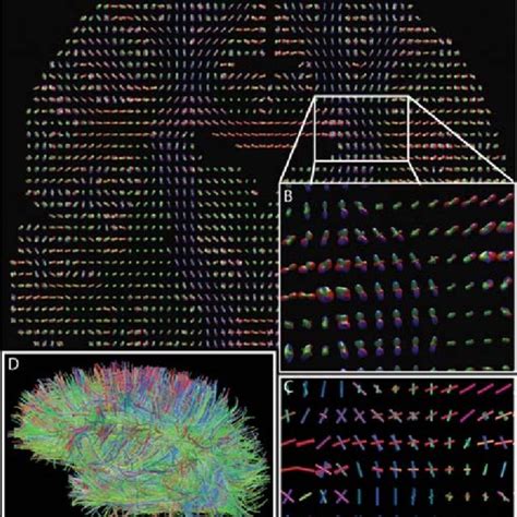 Tractography A The Result Of The Diffusion Mri Acquisition Step Download Scientific