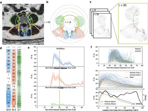 Workflow From Mri Segmentation To Statistical Parametric Mapping Download Scientific Diagram