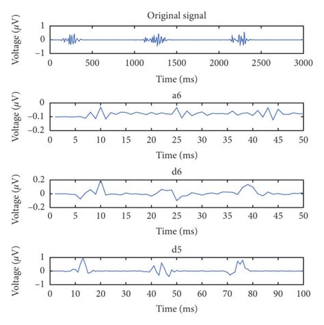 Wavelet Feature Extraction Of Semitendinosus Signal Download