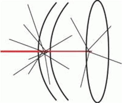 Glare And Contrast Sensitivity Testing Ento Key