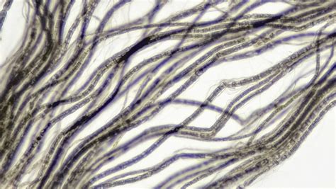 Nervous Tissue Nerve Bundle Photo Free Pattern Image On Unsplash