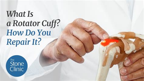 Rotator Cuff Va Claim At Jean Begaye Blog