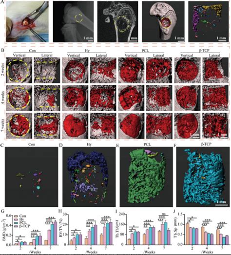 上交大附属瑞金医院团队：3d打印支架共生微巣促进骨缺损愈合的机制研究 3d科学谷