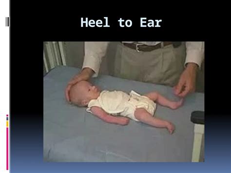 Neonatal Gestational Age Calcualtions Pic Pptx