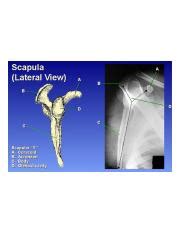 Understanding Scapula Anatomy: Coracoid, Acromion, and Glenoid | Course ...
