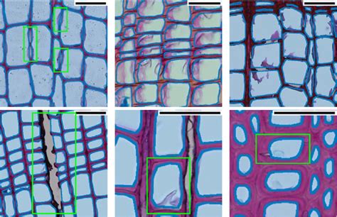 Examples Of Corrected Issues In The Cell Outlines Of The Manually Download Scientific Diagram