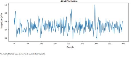 neural network output by console download scientific diagram