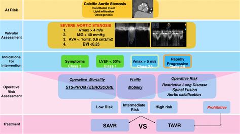 Suggested Algorithm For The Diagnosis And Management Of Aortic Stenosis