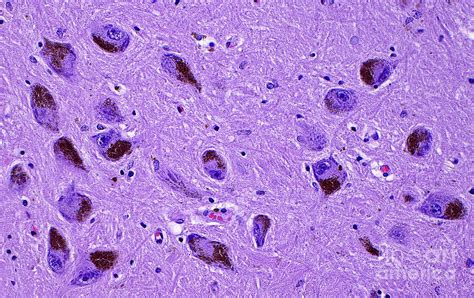 Substantia Nigra Cells By Ziad M El Zaatariscience Photo Library