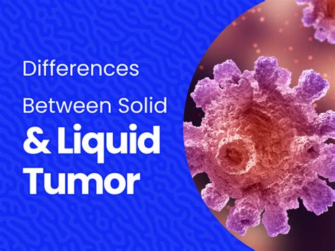 What Are The Differences Between Solid And Liquid Tumors