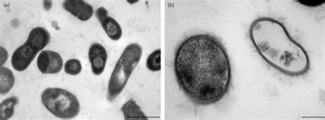 Electron Micrographs Of Cells Of Strain 9571414 J Bacterial