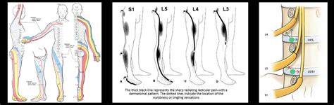 L5 Pain 5 Important Insights For Relief