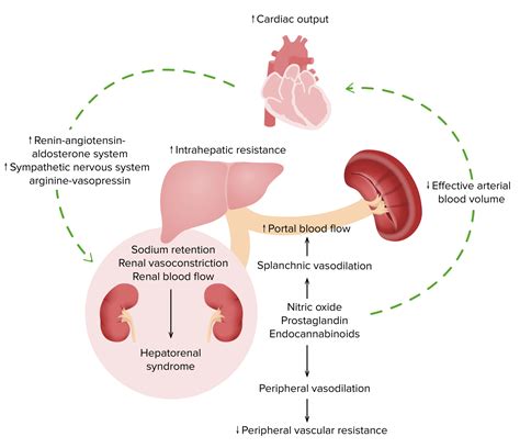 Hepatorenal Syndrome Concise Medical Knowledge