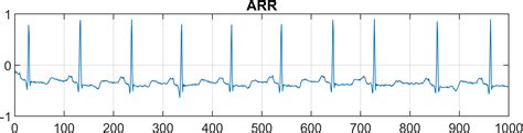 Github Farhadabedinzadehclassify Time Series Using Deep Learning